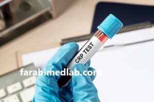 میزان نرمال آزمایش crp quantitative | بهترین آزمایشگاه تخصصی تهران ️ ...